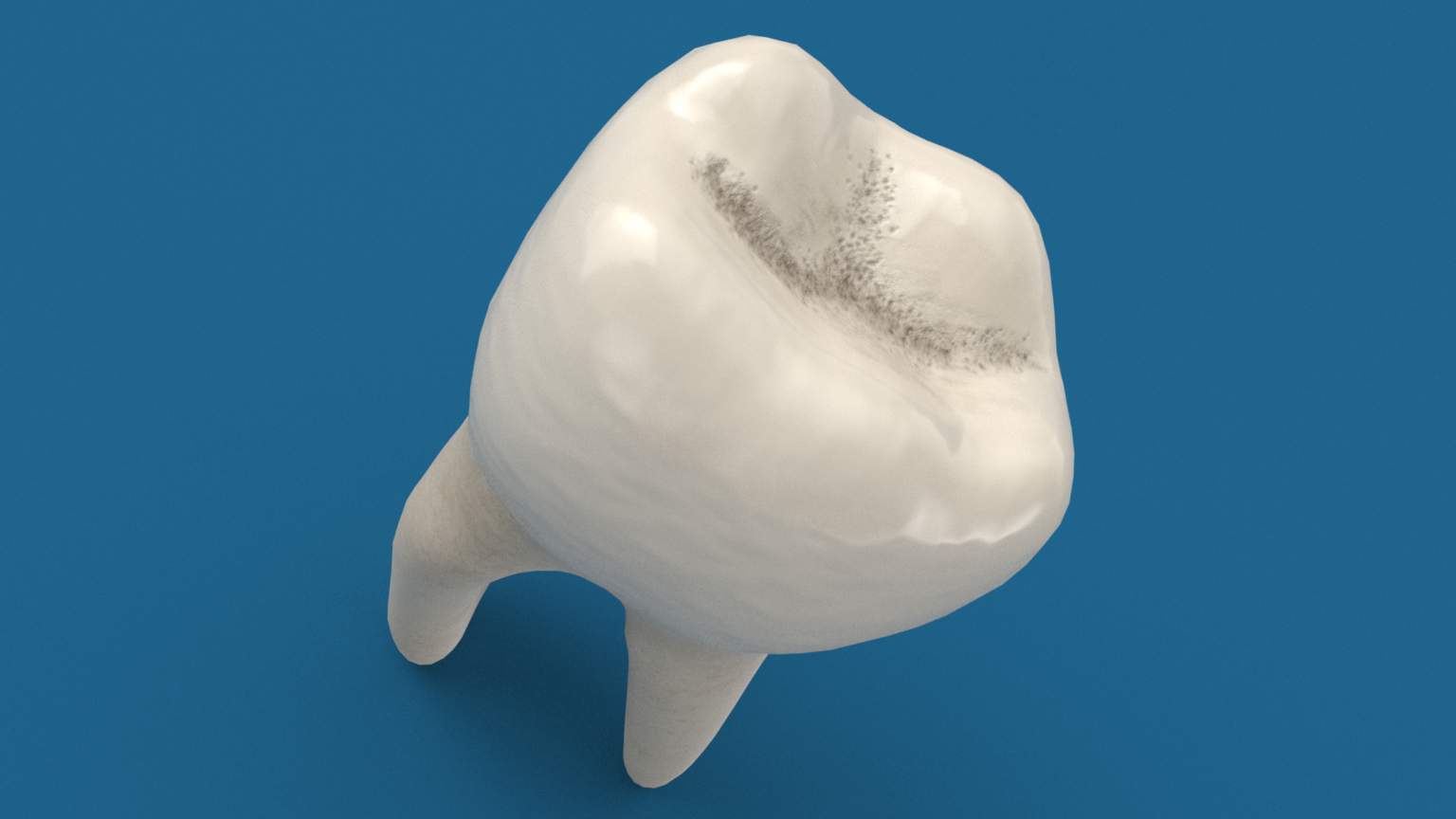 3D Model of Molar Tooth - Kezan's Portfolio