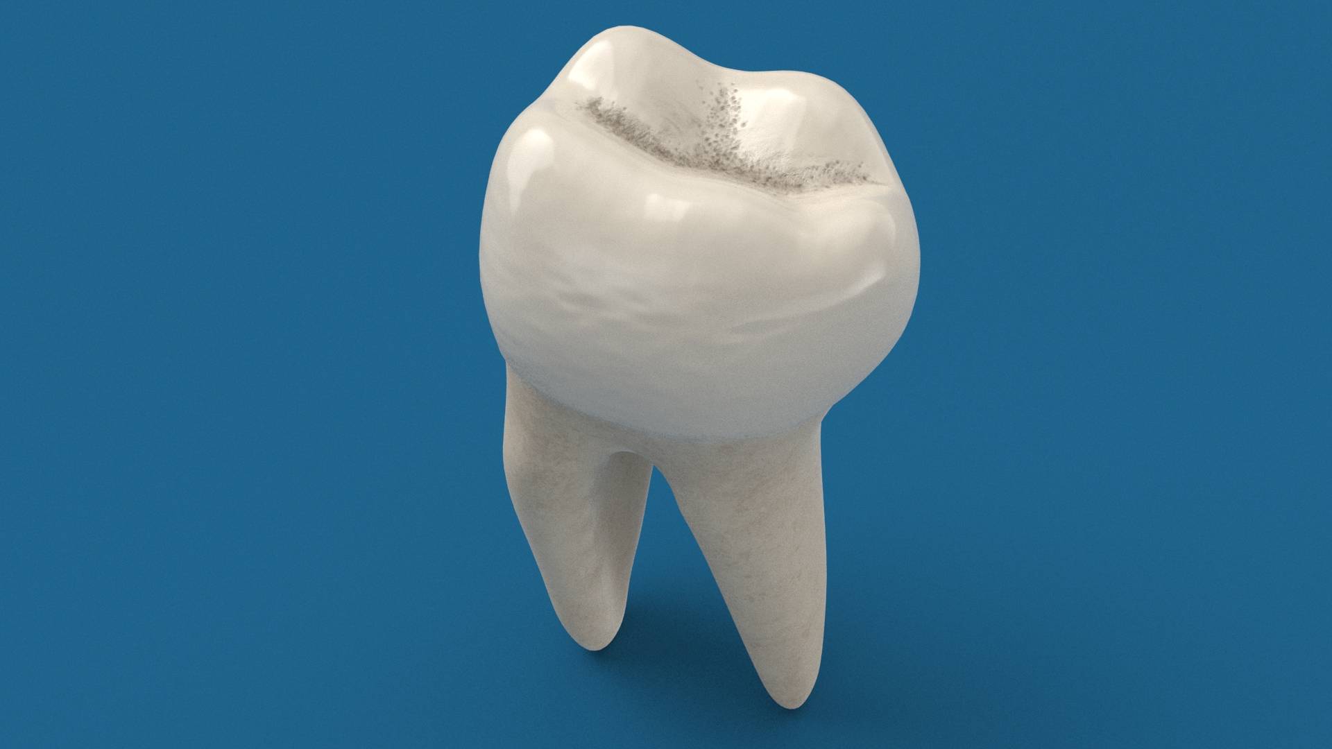 3D Model Of Molar Tooth Kezan s Portfolio 3D Model Of Molar Tooth Kezan s Portfolio