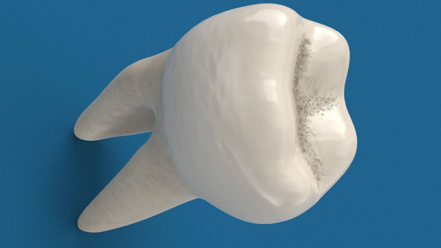 3D Model of Molar Tooth - Kezan's Portfolio